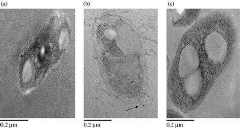 Comparison Of Free Tobramycin And Liposomal Tobramycin Penetration Download Scientific Diagram Comparison Of Free Tobramycin And Liposomal Tobramycin Penetration Download Scientific Diagram