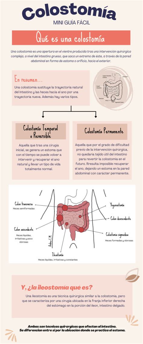 Colostomía Todo Lo Que Necesitas Saber Guía Paso A Paso Enfermera