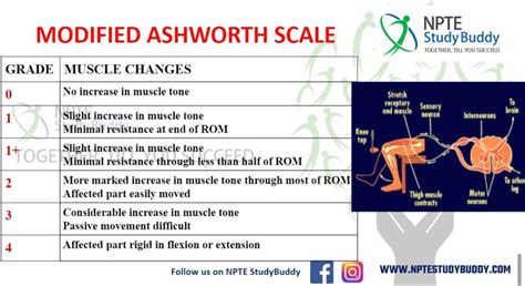 Modified Ashworth Scale Spasticity Artofit