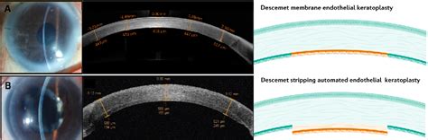 Figure 3 From Corneal Endothelial Like Cells Derived From Induced Pluripotent Stem Cells For