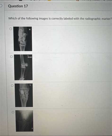 Solved Question 17which Of The Following Images Is Correctly