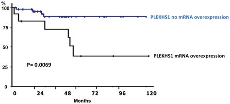 Progression Free Survival With Non Muscle Invasive Bladder Cancer By