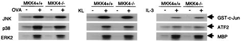 Role Of Mekk2 Mek5 In The Regulation Of Tnf α Gene Expression And Mekk2