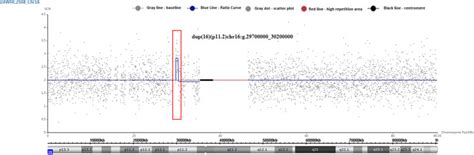 Prenatal Diagnosis And Molecular Cytogenetic Analyses Of A Rare 15q213