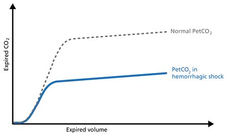 Basics Of Volumetric Capnography Part 3 Clinical Relevance