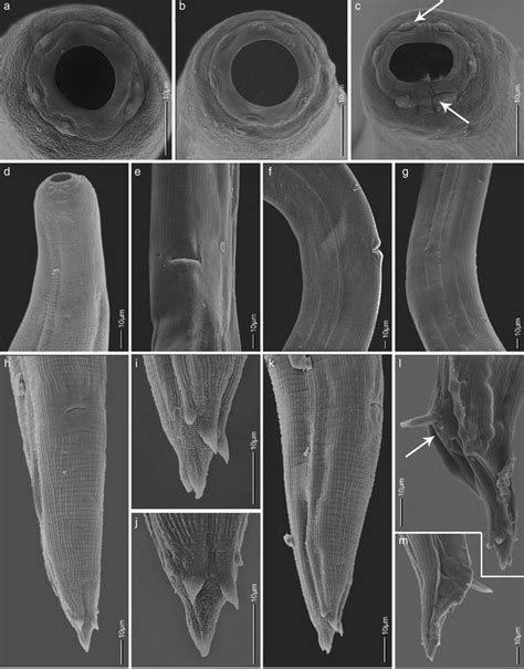 Nematode Electron Microscope