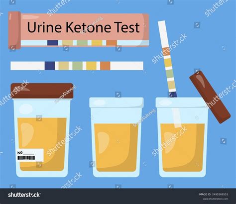 Urine Ketone Test Set Acetone Test Stock Vector Royalty Free