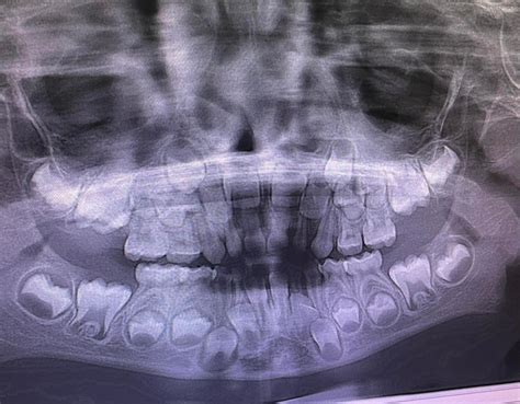 Black Mom White Dad