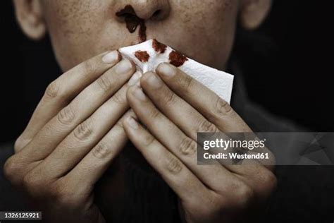 Woman Nose Bleed Photos And Premium High Res Pictures Getty Images
