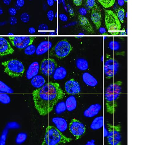 Stress Induces Modifications Of Enteric Neuronal Phenotype A