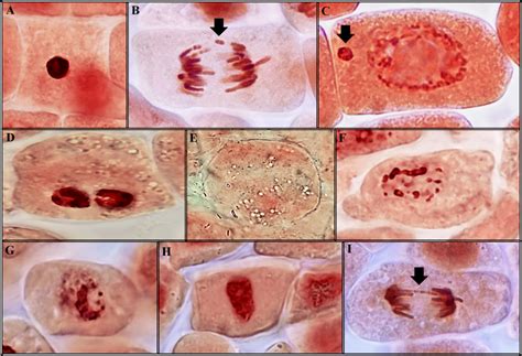 Chromosomal Abnormalities Found In The Mitotic Process Of P Sativum Download Scientific