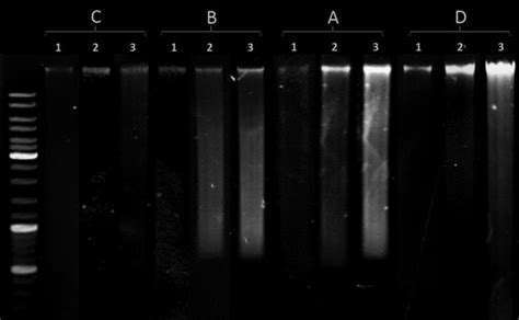 Agarose Gel Picture Of Dna Extracted From The Soil With Method C B A