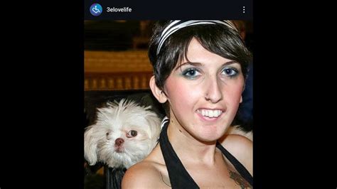 Annie Hopkins Sosok Penyandang Disabilitas Di Balik Hari Penerimaan