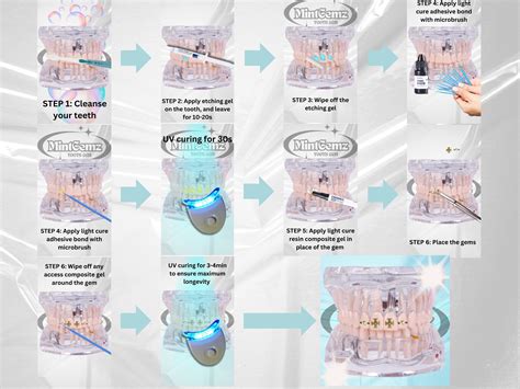 Professional Tooth Gem Adhesive Glue Kit With Uv Glue Gel And Bonding