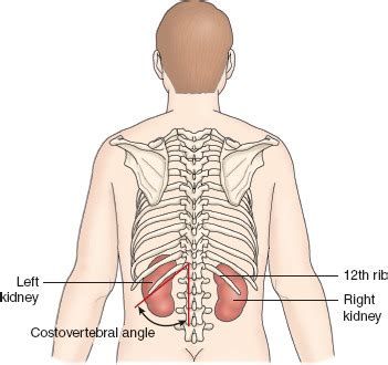 Costovertebral Angle