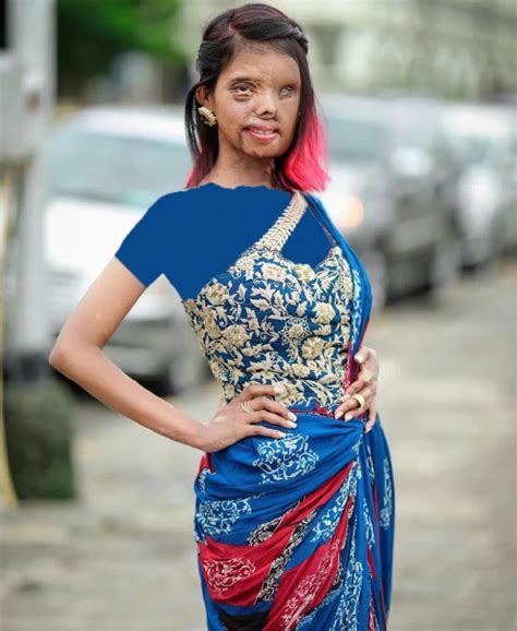 داستان الهام بخش زندگی دختر قوی هندی از دو ماهگی تا به حال