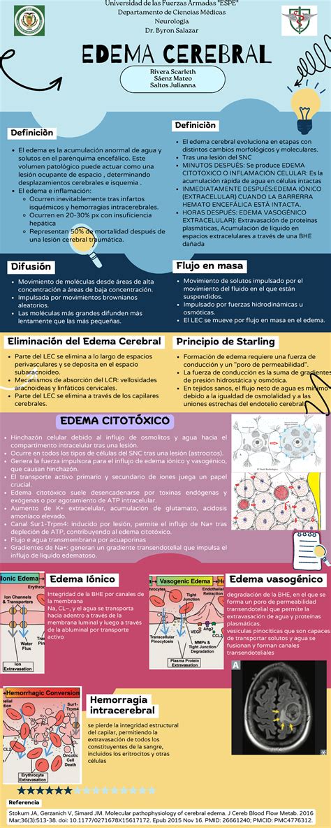 Infografía Edema Cerebral Rivera Scarleth Sáenz Mateo Saltos Julianna