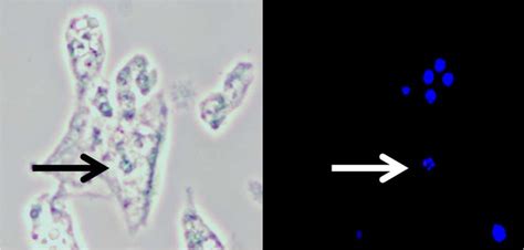 Microscope Image Of Single Cells Prepared From Qd Treated Hydra Left