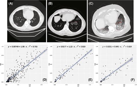 Results Of The Ct Segmentation Network Abc Three Segmentation
