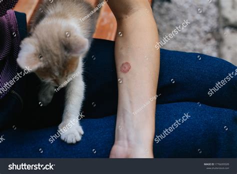 Ringworm In Cats Paws