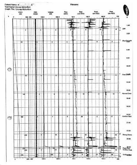 Related To The Results Reported In The Text The Chart Of The