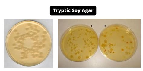 Deoxycholate Citrate Agar Dca Composition Principle Preparation
