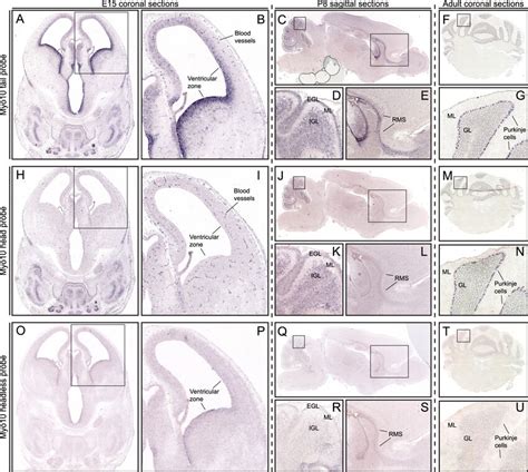 Localization Of Full Length And Headless Myo10 In The Developing Mouse