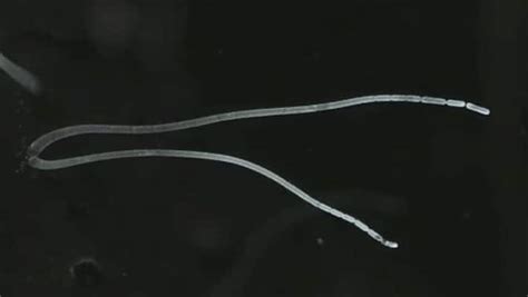 The Worlds Largest Bacterium Found In Caribbean Swamps