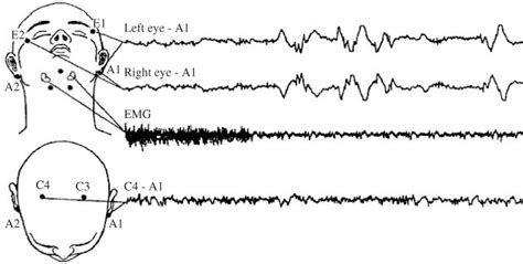 Eeg Sleep Study Creationaceto