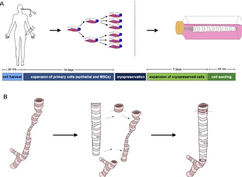 Strategy For Delivering The Cell Seeded Decellularized Trachea