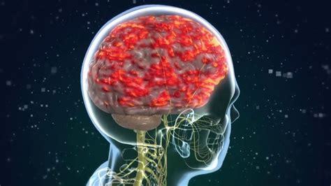 Multiple Sclerosis Definition Risks And Causes