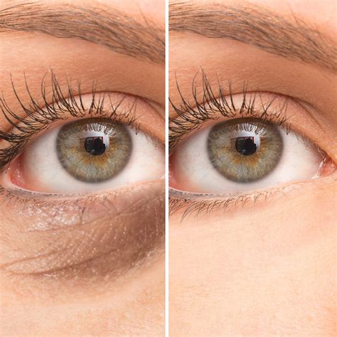 Lumin Eye Konsentrert Serum For Mørke Ringer