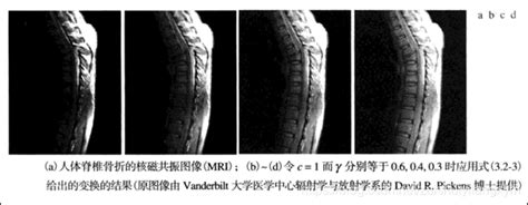 数字图像处理18 图像灰度变换——线性灰度变换 和 非线性灰度变换对数变换 与 伽马变换医学图像处理非线性变换 Csdn博客