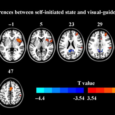 The Basal Ganglia Mask From The Aal Template Aal Anatomical Automatic Download Scientific