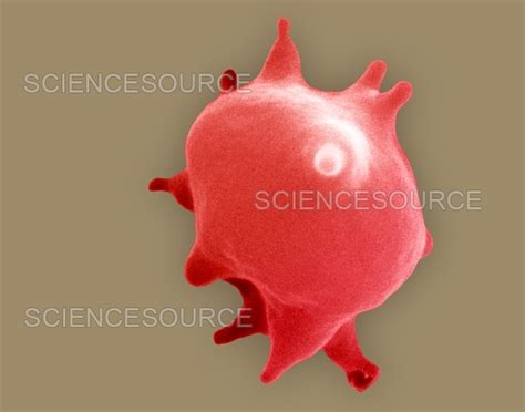 Hypertonic Red Blood Cell