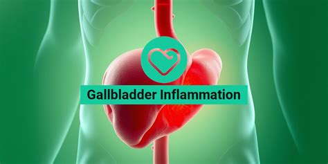 Gallbladder Inflammation Understanding Symptoms Causes And Treatments • Yesil Health