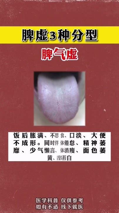 脾虚分型 自然疗法 医学科普 中医 Youtube 脾虚分型 自然疗法 医学科普 中医 Youtube