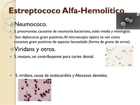 Ppt Streptococcus Powerpoint Presentation Free Download Id2341409
