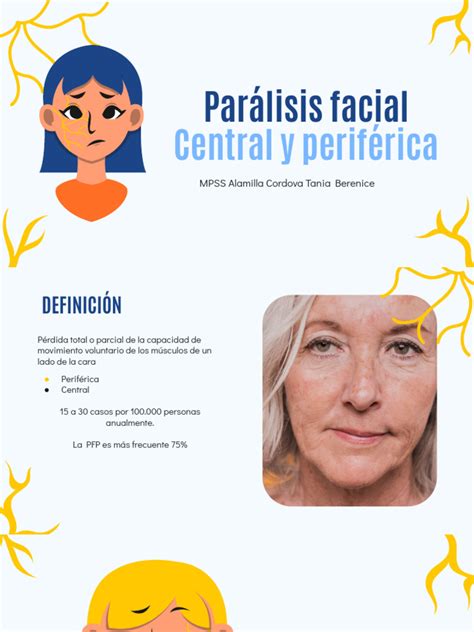 Parálisis Facial Tipos Causas Y Tratamientos Pdf Nervio