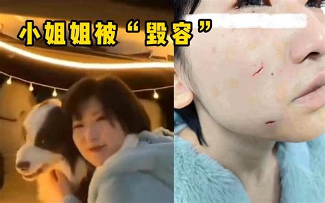 小姐姐作死亲吻陌生狗狗，当场被咬 毁容”，太惨了 哔哩哔哩