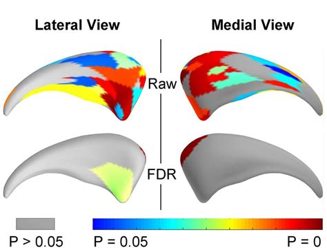 Right Caudate Shape Analysis Results Significance Maps For The Swc