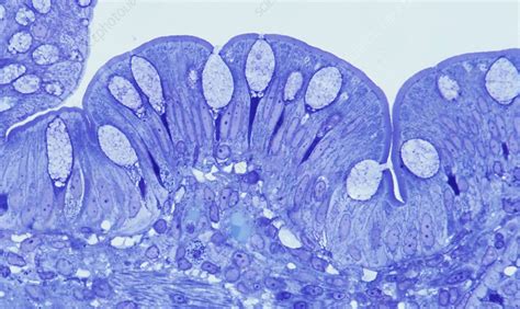 Human Intestine Light Micrograph Stock Image C0286605 Science