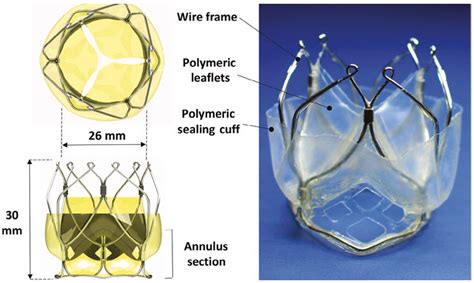 Polymeric Heart Valves Do They Represent A Reliable Alternative To