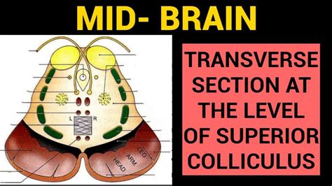 Mid Brain Anatomy 33 Ts At The Level Of Superior Colliculus Youtube