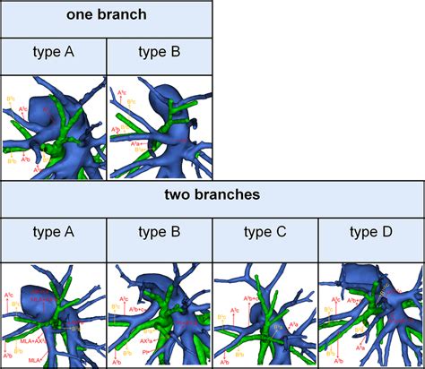 3d Reconstruction Model Of Branching Patterns Of The A³ Download Scientific Diagram