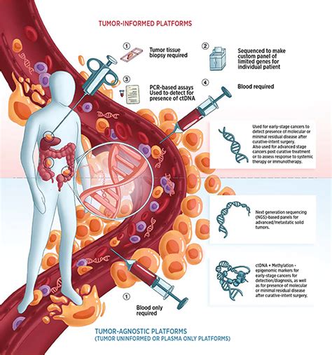Ctdna Assays Exploring Their Clinical Use In Oncology Care