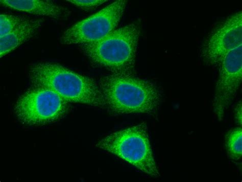 Calnexin Antibody 66903 1 Ig Proteintech 武汉三鹰生物技术有限公司