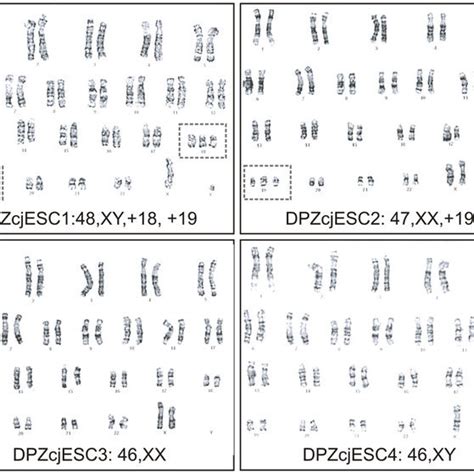 Karyotyping And Determination Of The Sex Karyotype Analysis Of The