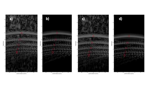 Simulated Us Images From An Hilbert Analytical Signal Envelope