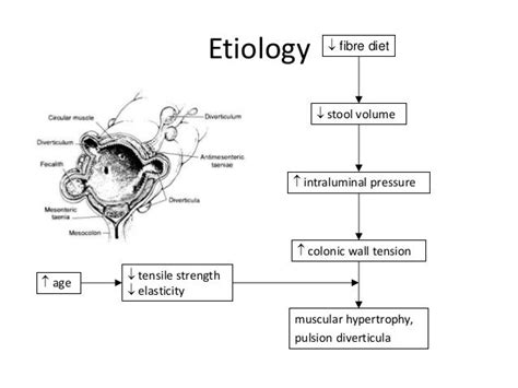 Diverticulosis And Diverticular Disease Ppt